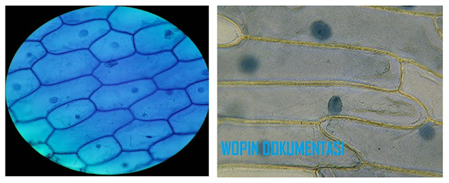 Struktur Sel Pada Jaringan Epidemis Bawang Merah (Vakoula) | WOPIN BLOG