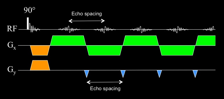 practiCal fMRI: the nuts & bolts: Physics for understanding fMRI ...