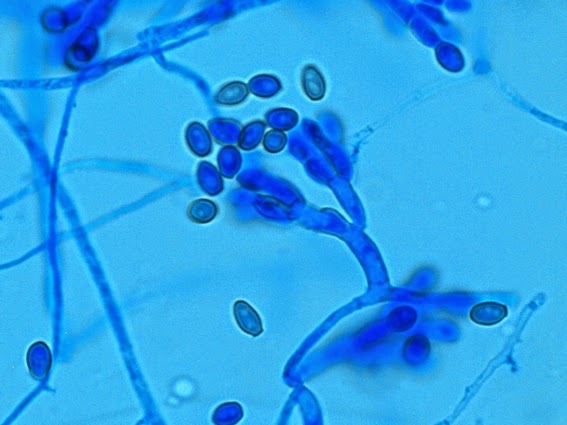 Fun With Microbiology (What's Buggin' You?): Scopulariopsis brumptii