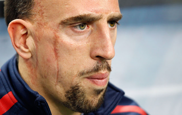 5 Footballers With Distinctive Scars | FOOTY FAIR