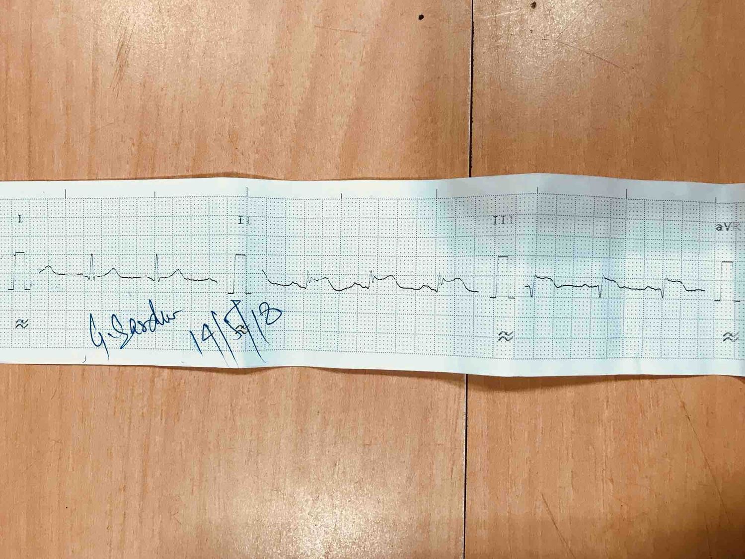 MEDICAL-MCQ/PGQUESTIONS: INTERESTING ECG 3