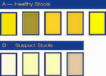 Stool colour : r/medical