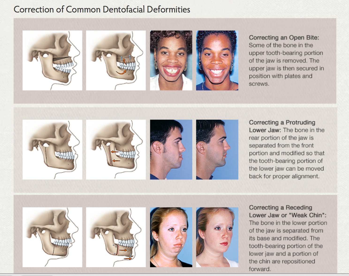 Information on Orthodontics, TMJ and Jaw Surgery: 2014