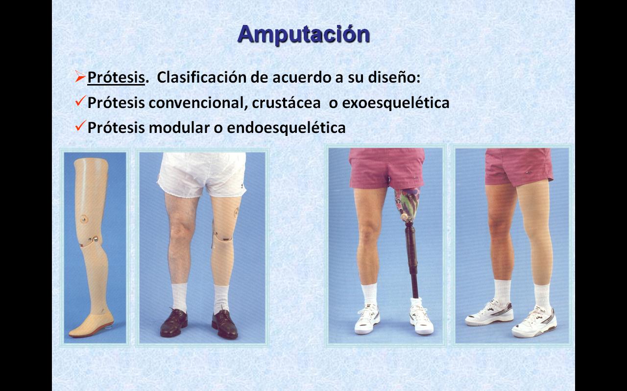 Definición y Fundamentos de Medicina Física y Rehabilitacion