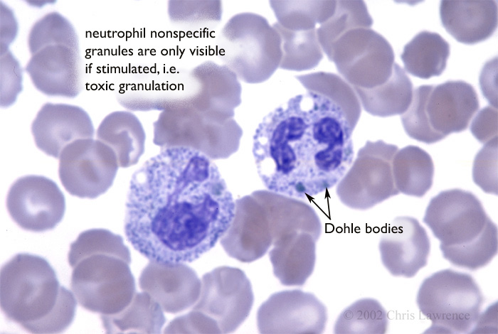 EXAMS AND ME : Dohle