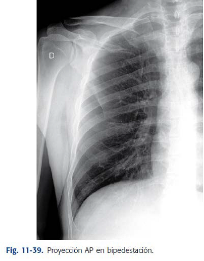 PRODUCCION Y TRATAMIENTO DE IMAGENES DIAGNOSTICAS: CAPITULO TÓRAX OSEO ...