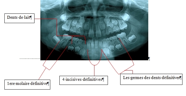 Tout Savoir Sur Le Dentaire: La dentition de l'enfant