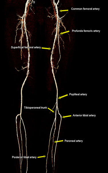 Radiology Anatomy Images Lower Limb Arteries Lower Limb Ct Angiography Anatomy