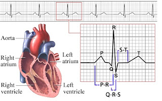 Aplikasi Instrumentasi Medis: Electrocardiogram (ECG)