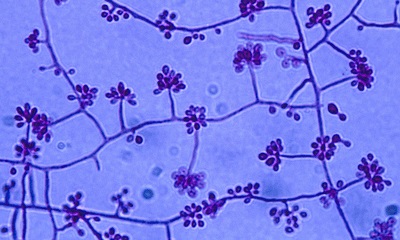 Lecture Notes in Medical Technology: Lecture #16: INTRODUCTION TO MYCOLOGY