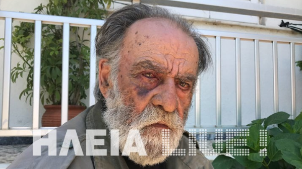ΡΕ Π@ΥΣΤΗΔΕΣ ΣΕ ΚΑΝΕΝΑΝ ΔΕ ΑΞΙΖΕΙ ΑΥΤΟ!!! ΘΛΙΒΕΡΗ ΕΙΚΟΝΑ: ΜΕΛΑΝΙΑΣΜΕΝΟΣ ...