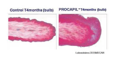hair treatment pilose shampoo | tradekorea