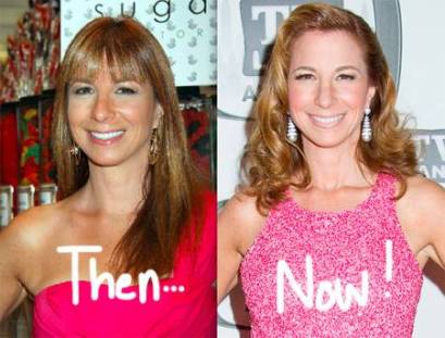 Jill Zarin Plastic Surgery Before and After Botox - Star Plastic ...