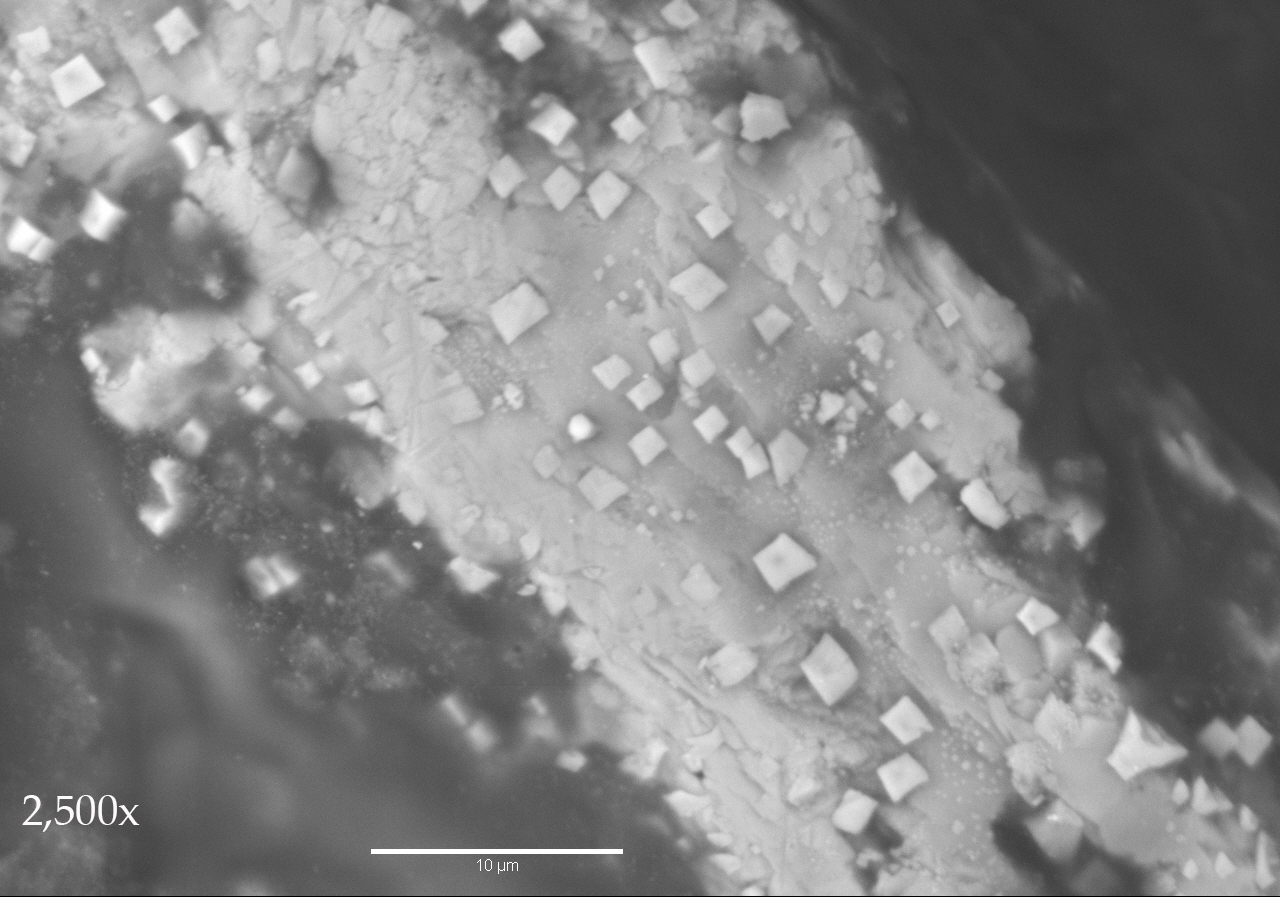 Scanning Electron Microscope Blog