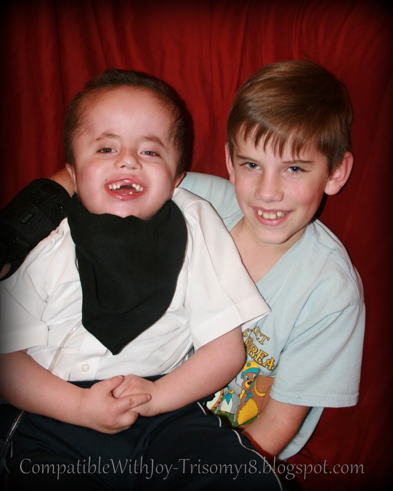 Compatible With Joy-Trisomy18: He Ain't Heavy, He's My Brother