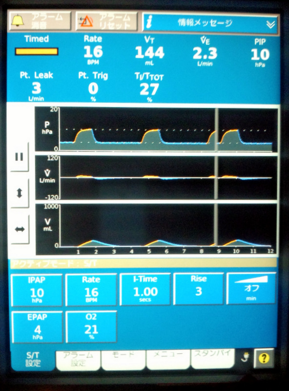 ぐうたら臨床工学技士のしがない日々: PHILIPS社製 Respironics V60を借りてみた