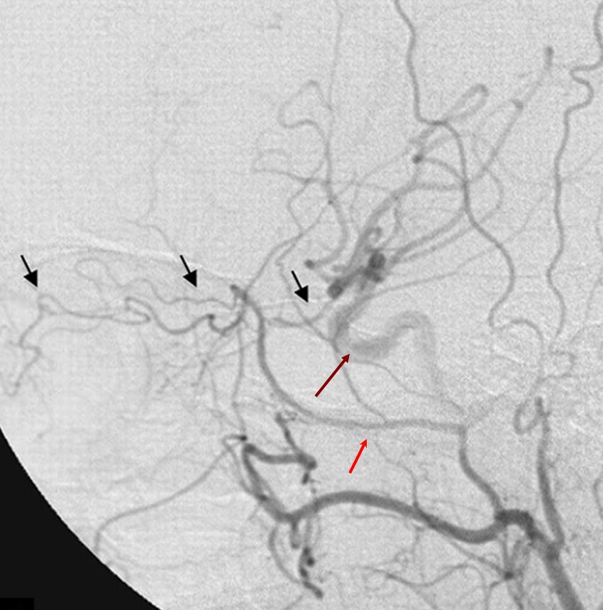 Ten Things That I Learned Today