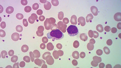 Medical Laboratory and Biomedical Science: New method to restore ...