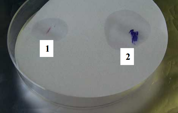 Xét nghiệm Y học: Nuôi cấy, phân lập, định danh Trực khuẩn Mủ xanh ...