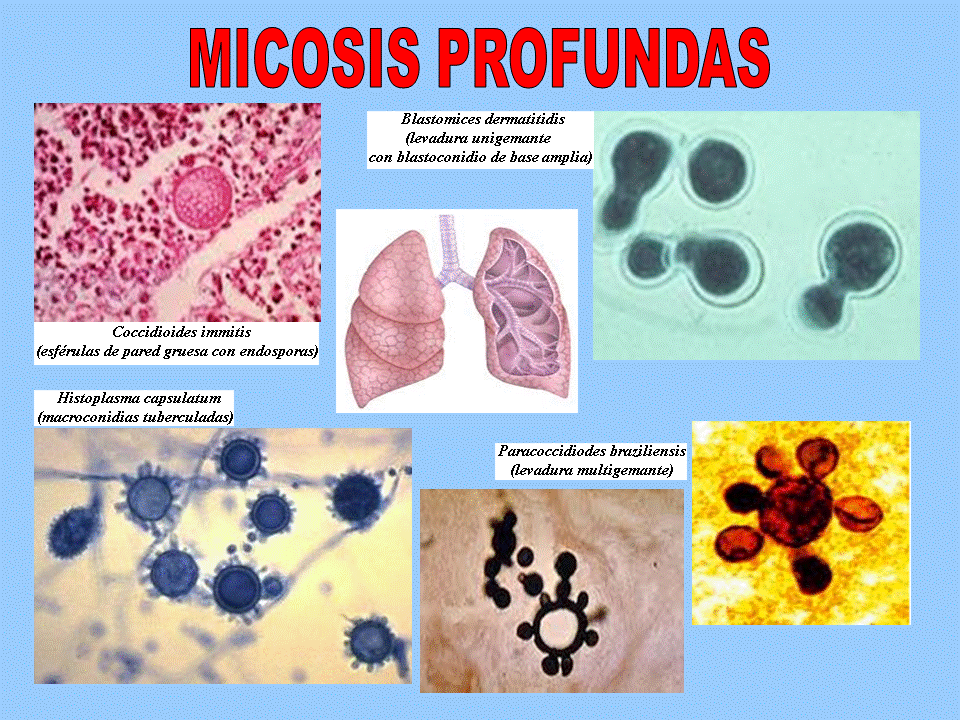MED 331-332: ENFERMEDADES INFECCIOSAS: SINDROMES INFECCIOSOS