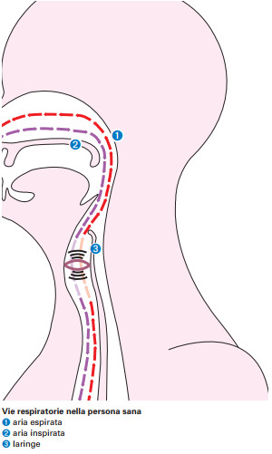 Laringe artificiale - Искусственная гортань - Artificial larynx ...