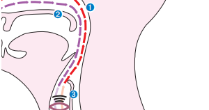 Laringe artificiale - Искусственная гортань - Artificial larynx ...