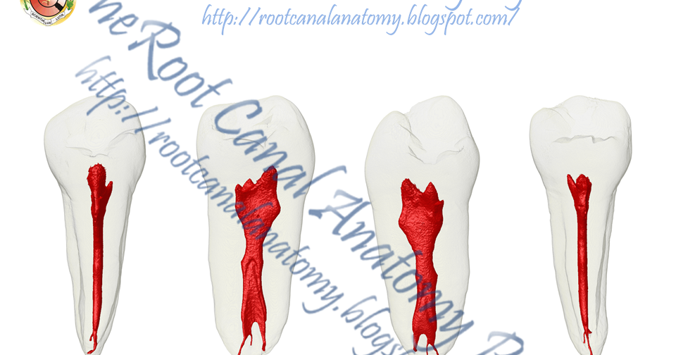 The Root Canal Anatomy Project: Mandibular First Premolar