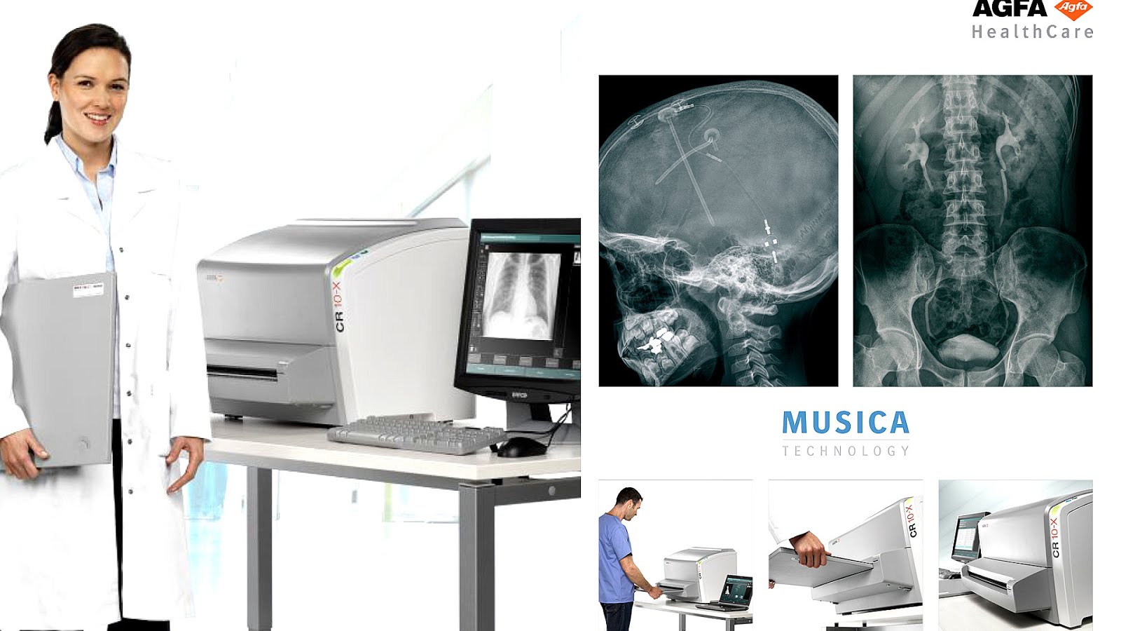 Digital radiography - Computed Radiography - Radio Choices