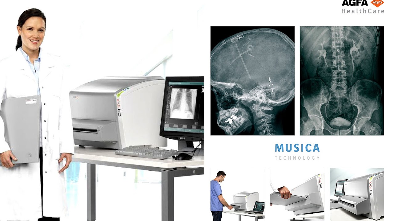 Digital radiography - Computed Radiography - Radio Choices Digital radiography - Computed Radiography - Radio Choices