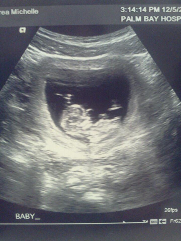 Our Journey With Baby: Ultrasounds
