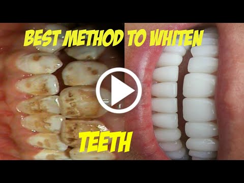 SIMPLE TRICK TO REMOVE BROWN DIRT FROM YOUR TEETH WITH THIS AMAZING ...
