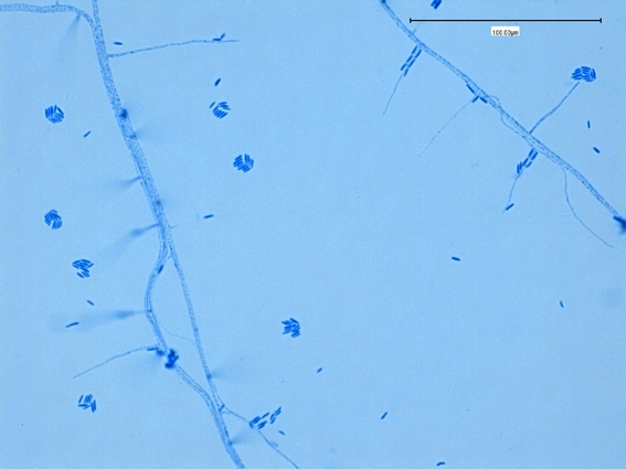 Fun With Microbiology (What's Buggin' You?): Sarocladium kiliense