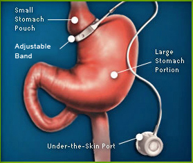 Wave at the Fat Lady