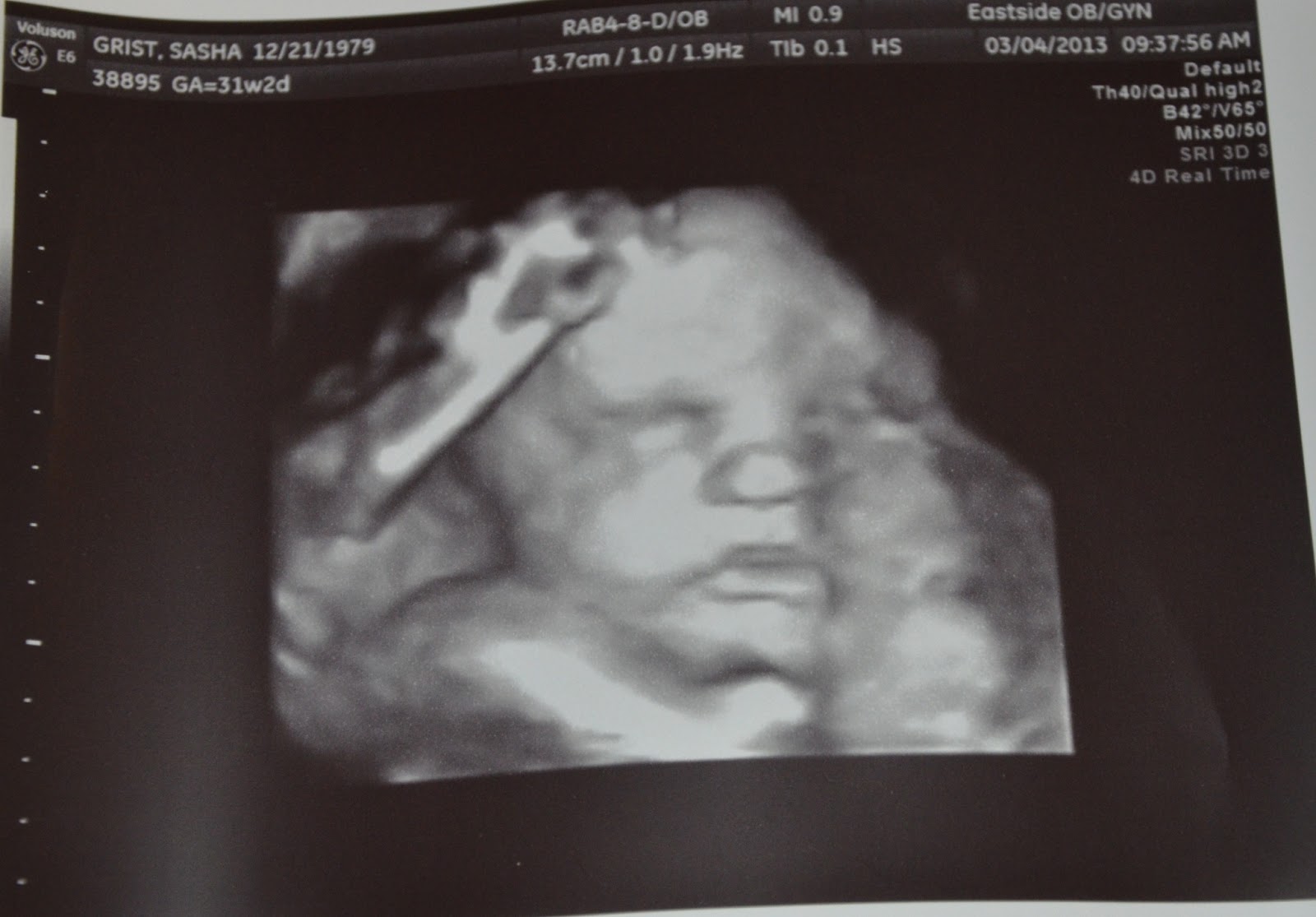 And Then There Were Five!: 31 Weeks Ultrasound