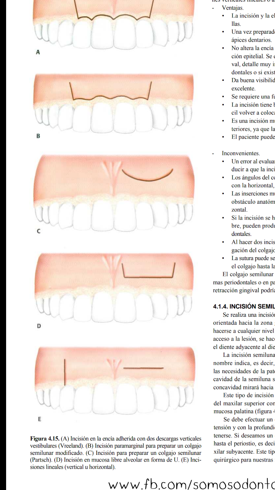 FUNDAMENTOS DE ANESTESIA Y EXODONCIA : INCISIONES Y SUTURAS