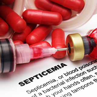 Septicemia