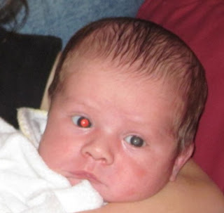 Tommy's Eyes: Red Reflex