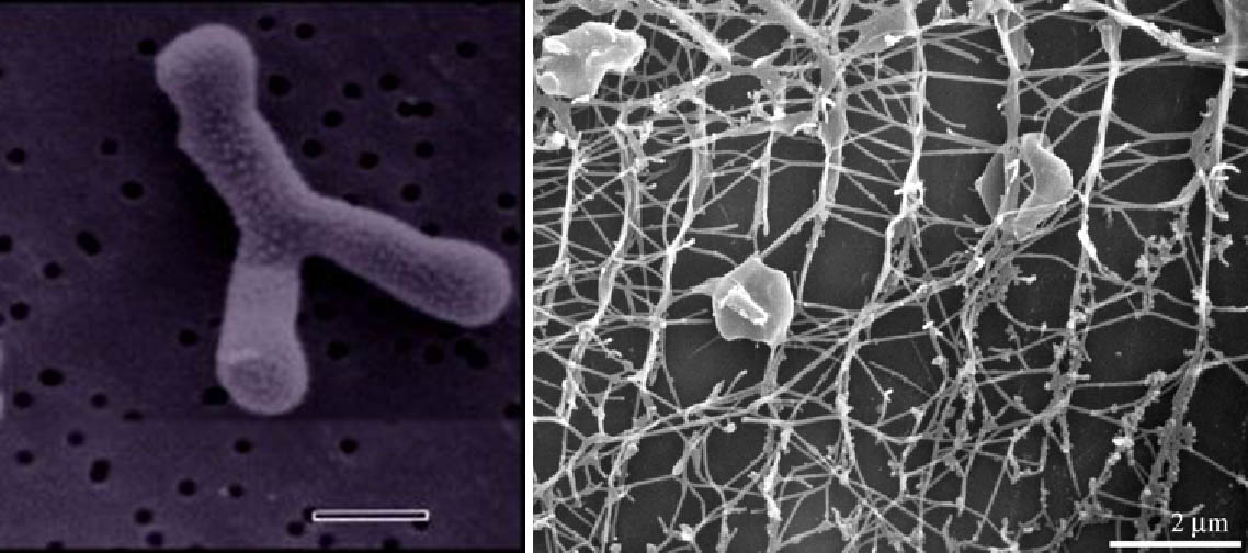 As Many Exceptions As Rules: How Prokaryotes Shape Up