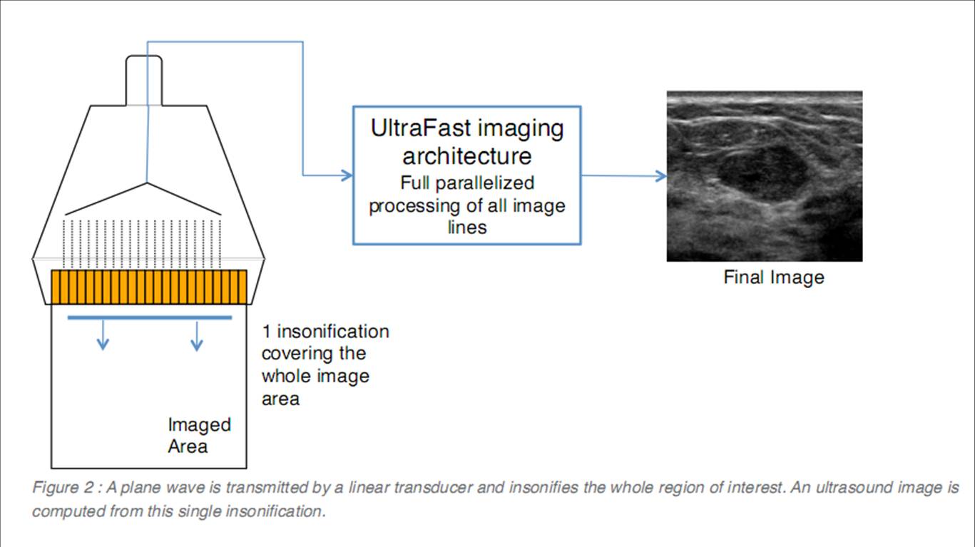 BÀI SOẠN VỀ SIÊU ÂM CHẨN ĐOÁN: UltraFast Doppler: kết hợp Pulsed Wave ...