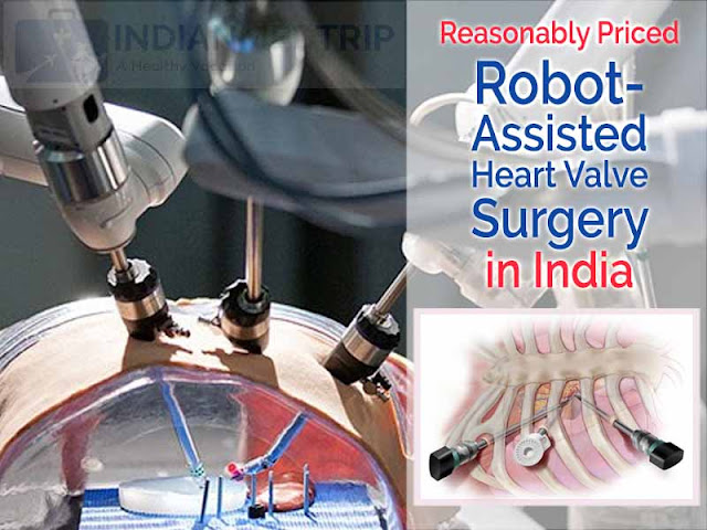 Robot-Assisted Heart Valve Surgery in India is Reasonably Priced ...