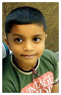 Pediatric Epilepsy & DNET Removal Surgery: Pediatric Epilepsy and DNET ...