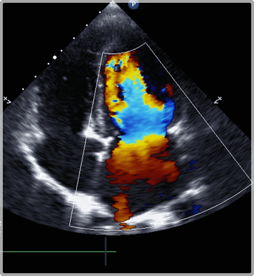 Ocala Family Medical Center: Color Flow Doppler Imaging ...