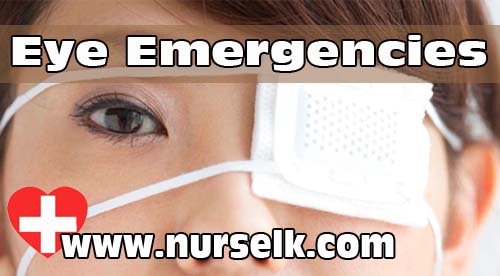 Eye Emergencies | Nurselk.com