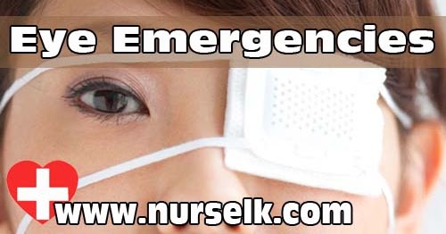 Eye Emergencies | Nurselk.com