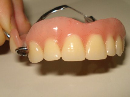 Laprotege: PPR,Prótese Parcial Removível