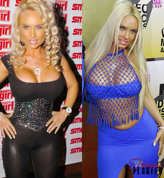 Coco Before Plastic Surgery Butt