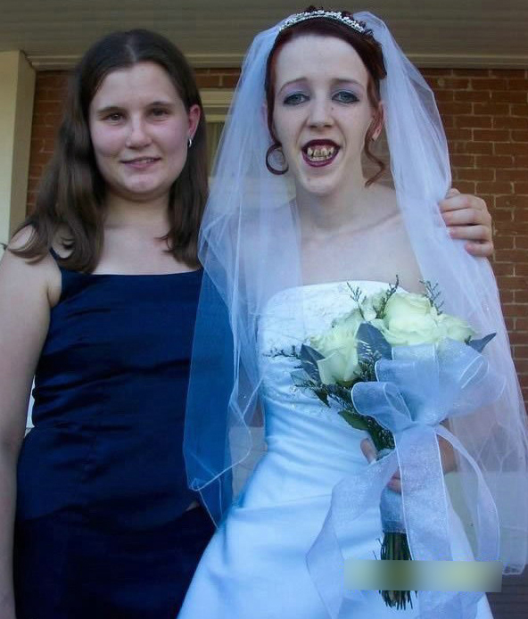 Ugliest Wedding Couple