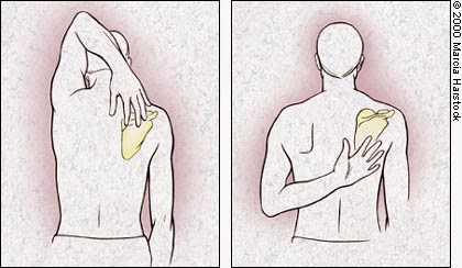 Shoulder / ПЛЕЧИ: The Painful Shoulder: Part I. Clinical Evaluation