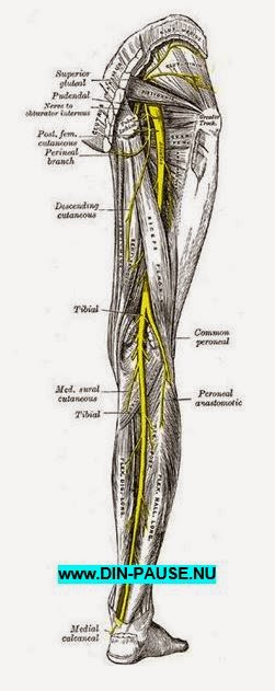 DIN-PAUSE.NU: Iskias - Nerve - Smerter?
