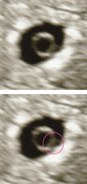 Just Relax and It Will Happen: 2015